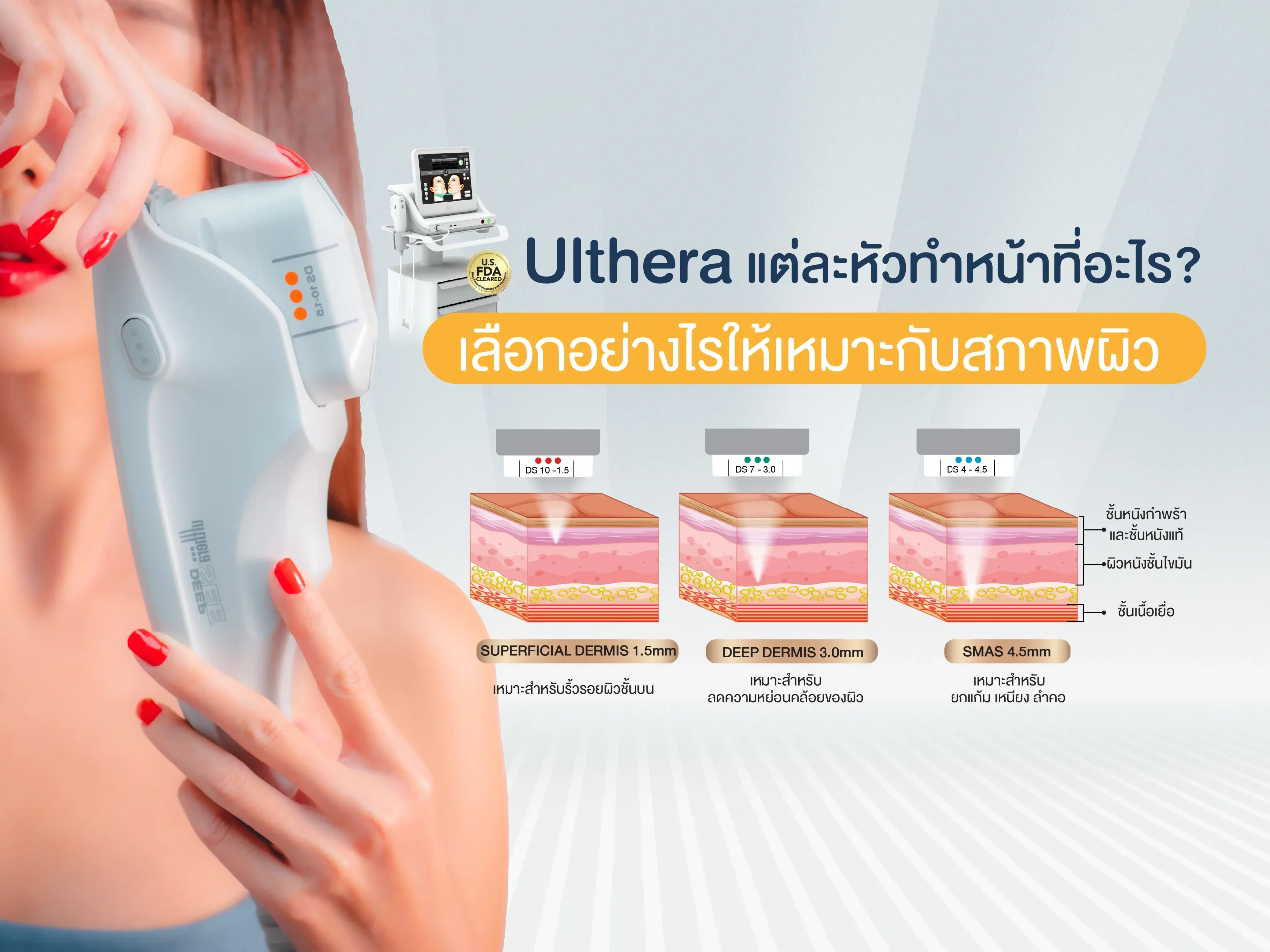 หัว Ulthera แต่ละหัวทำหน้าที่อะไร เลือกอย่างไรให้เหมาะกับสภาพผิว | La ...
